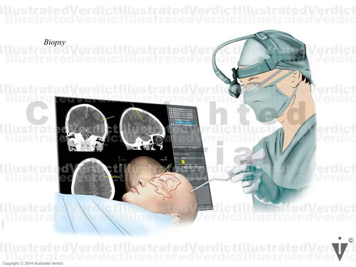 Stock Brain: Surgical Approaches — Illustrated Verdict