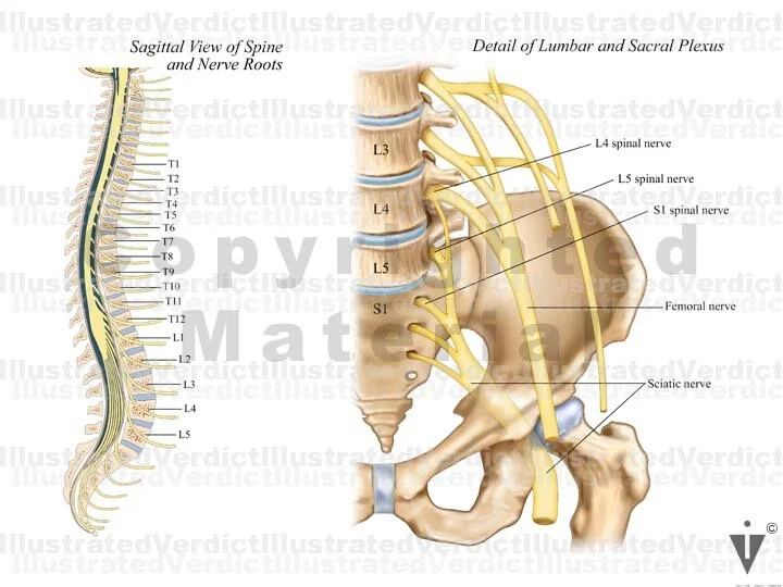 CASE AT A GLANCE Sciatic Nerve Injury W Hip Replacement Illustrated case-at-a-glance-sciatic-nerve-injury-w-hip-replacement-illustrated