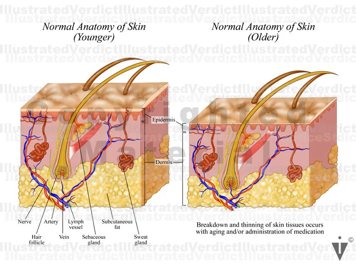 Stock Sepsis: Sepsis Overview — Illustrated Verdict