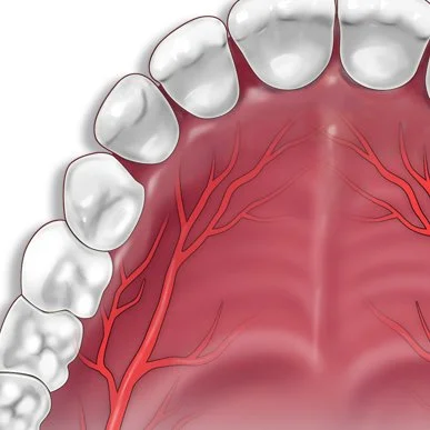 Iv Spotlight Illustrated Verdict