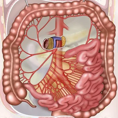 Iv Spotlight Illustrated Verdict