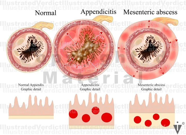 Stock Appendix: Normal Anatomy — Illustrated Verdict