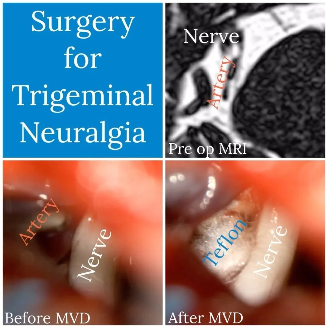 Matthew Mian, MD - Neurosurgeon in Denver, Colorado