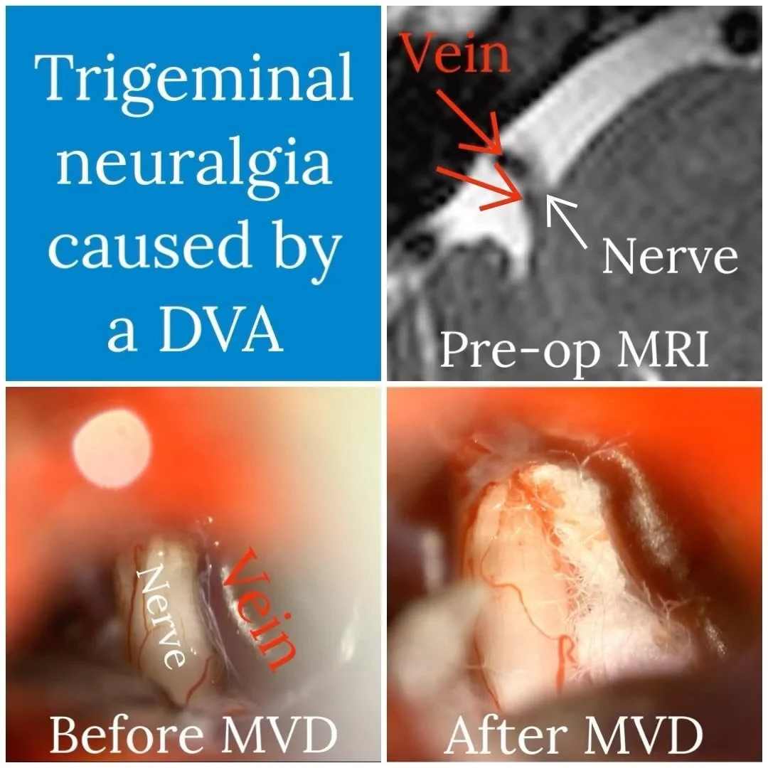 Matthew Mian, MD - Neurosurgeon in Denver, Colorado