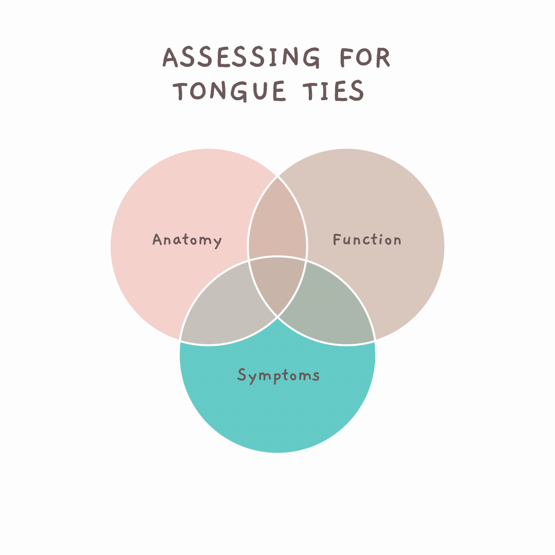 Tongue Tie | Baby Bonds, Boise | Breastfeeding Support | Lactation ...