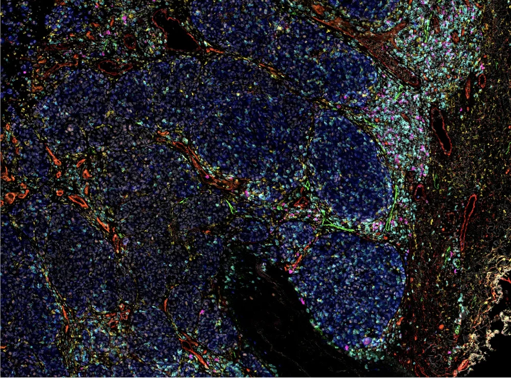 Research — Laboratory of Lymphatic Immunobiology