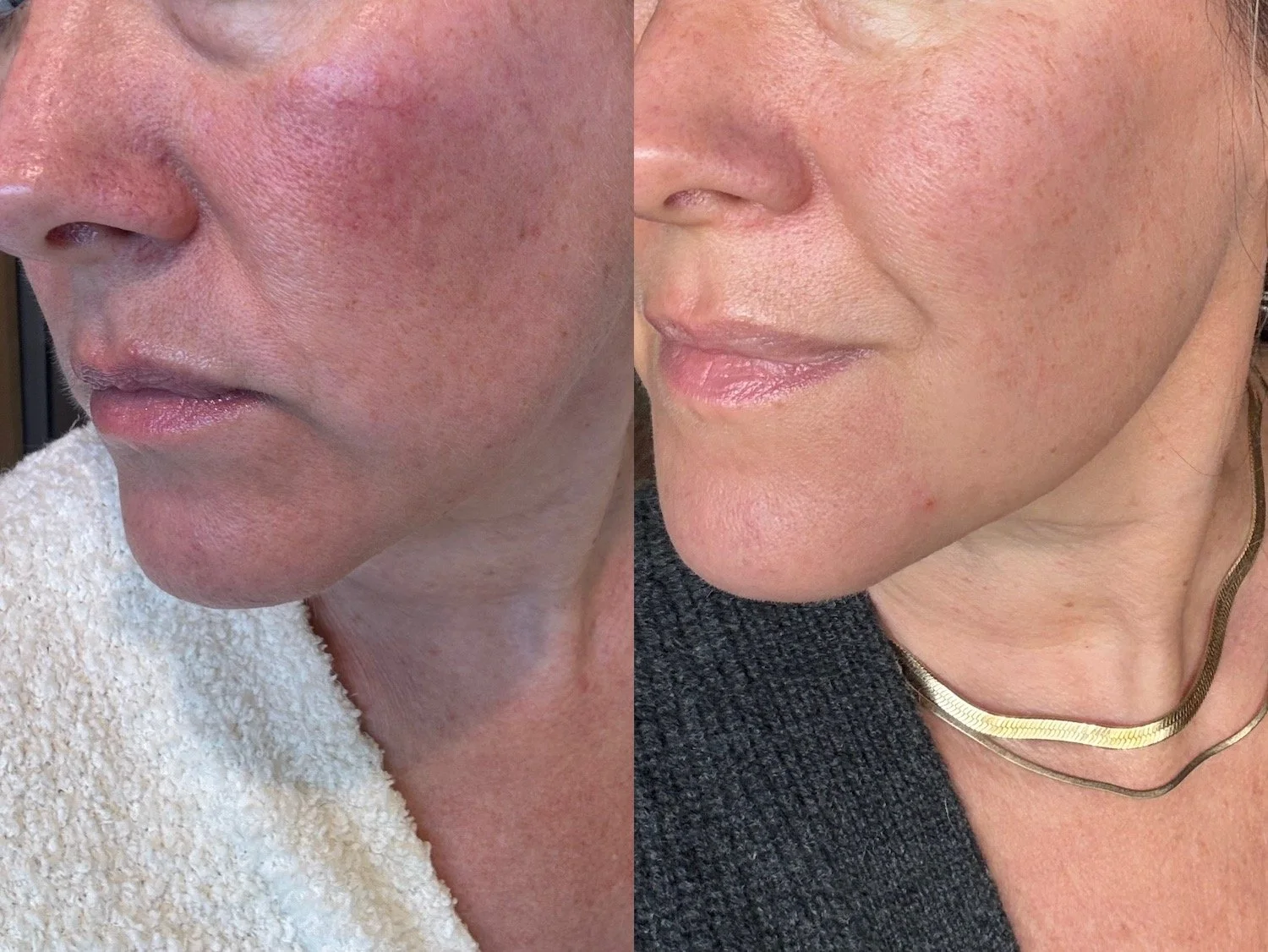 We Finally Tried This Cult Favorite Skincare Product And It Changed Our ...