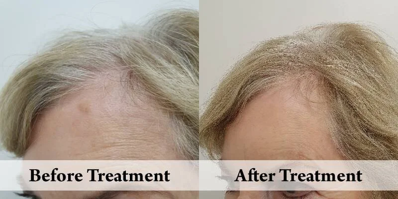 Minor Surgery — Panakeia (UK) Bedford