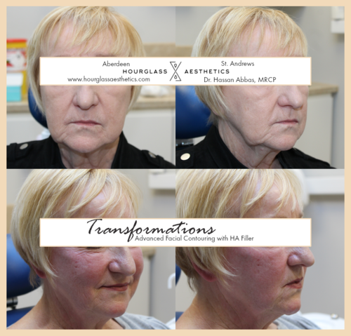 Clinic Procedure Gallery — Hourglass Aesthetics
