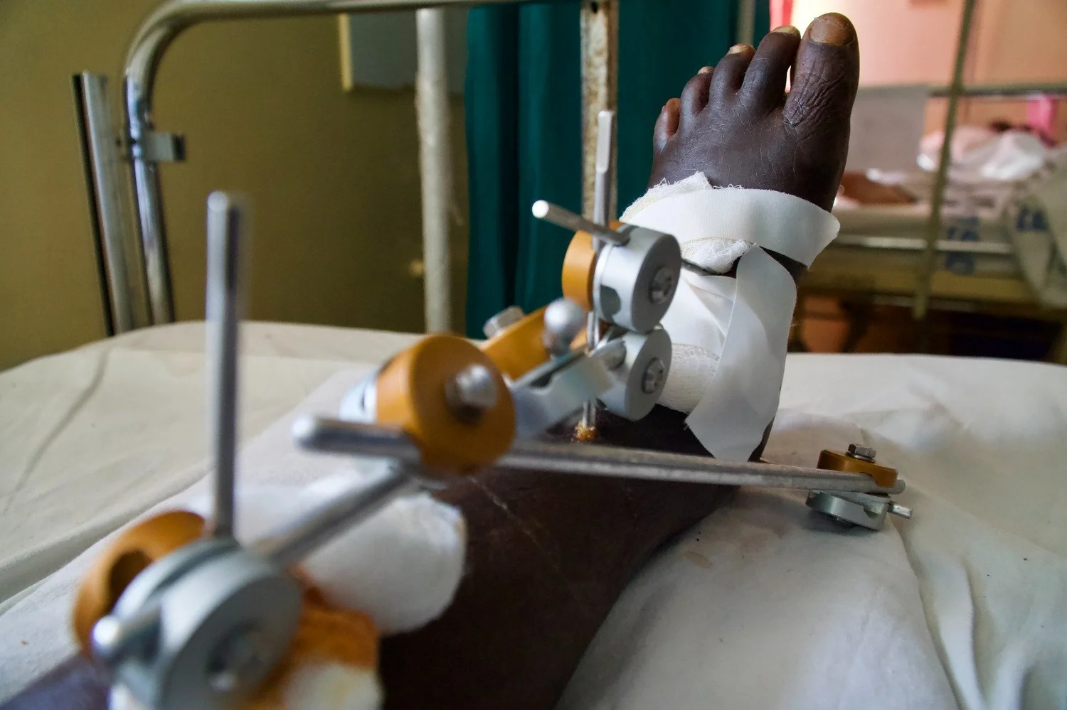 Programmes | Support Surgical Innovation Today — The Global Surgery Foundation