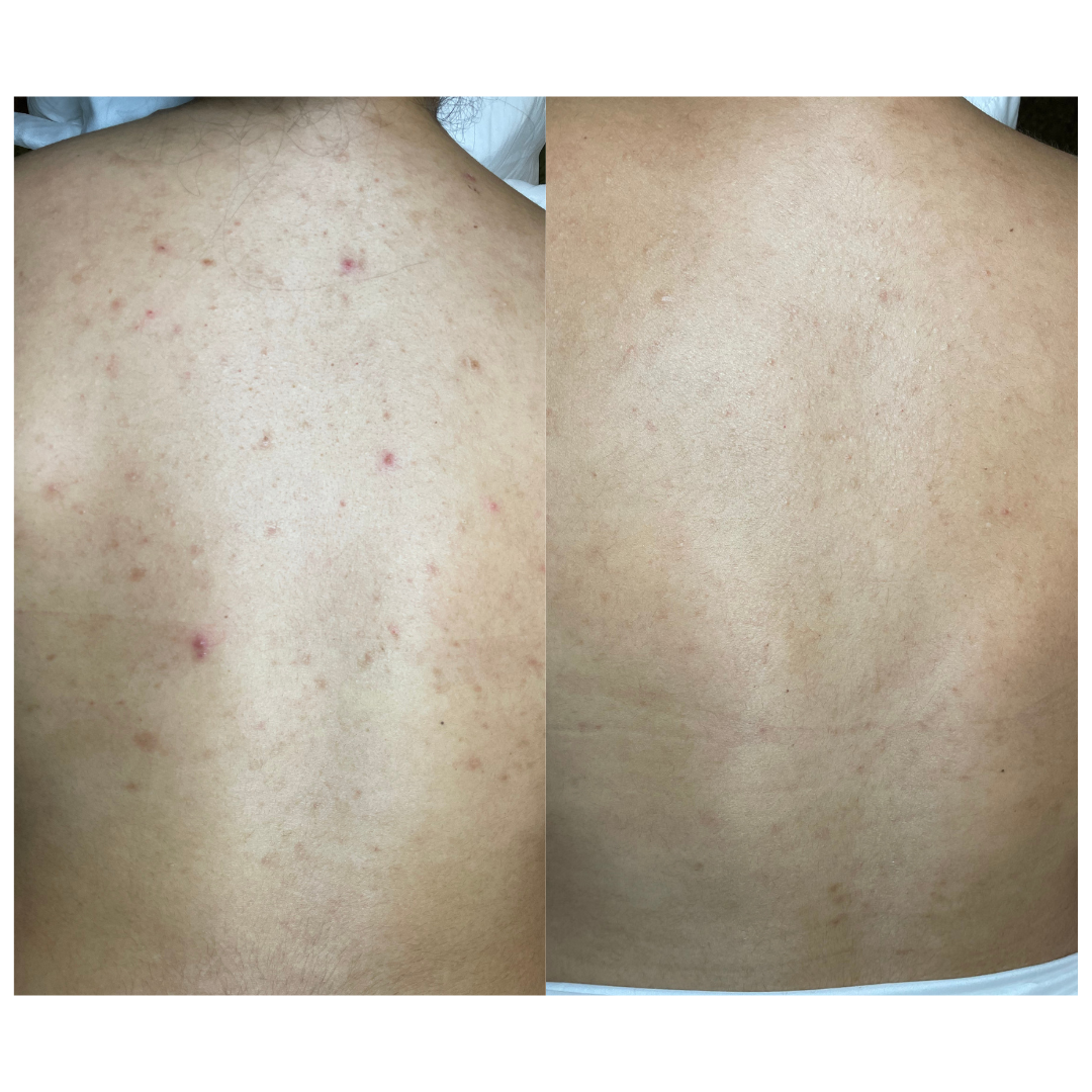 V's Skin Studio LLC | Appleton and Neenah, WI