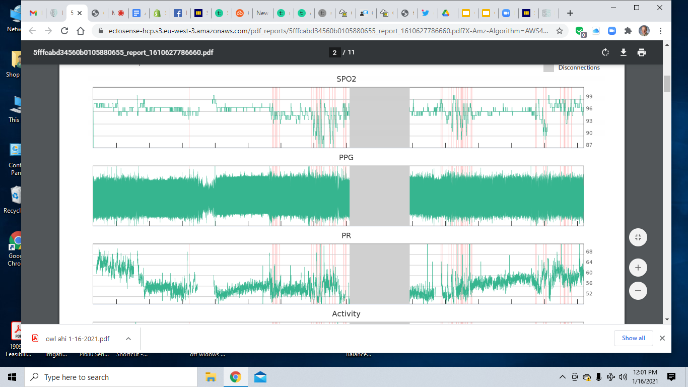 (#1) Z Machine, Ares or SleepImage Home Sleep Study (This is our sleep ...