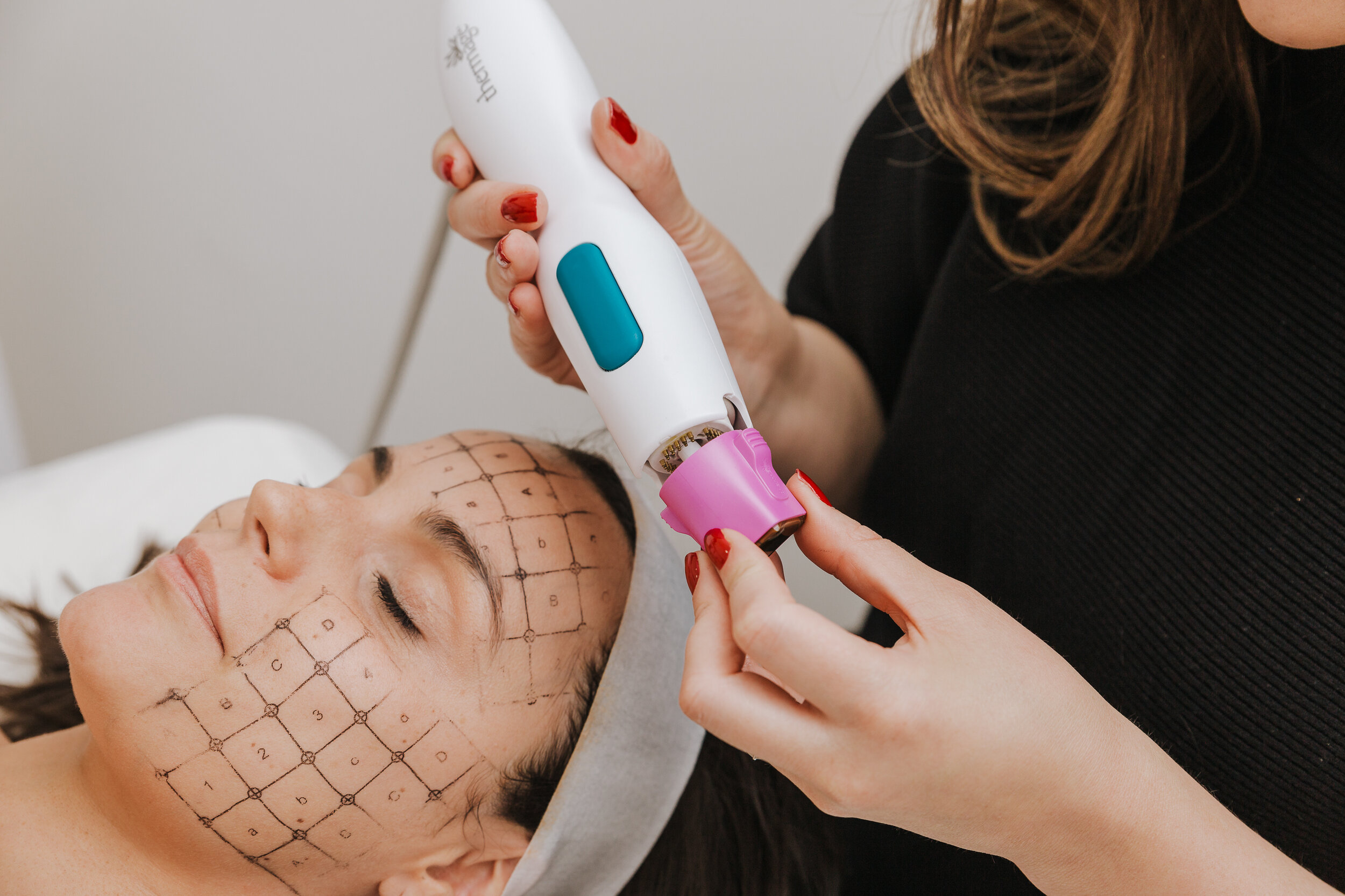 Thermage FLX Face — Bare Laser and Skin Clinic