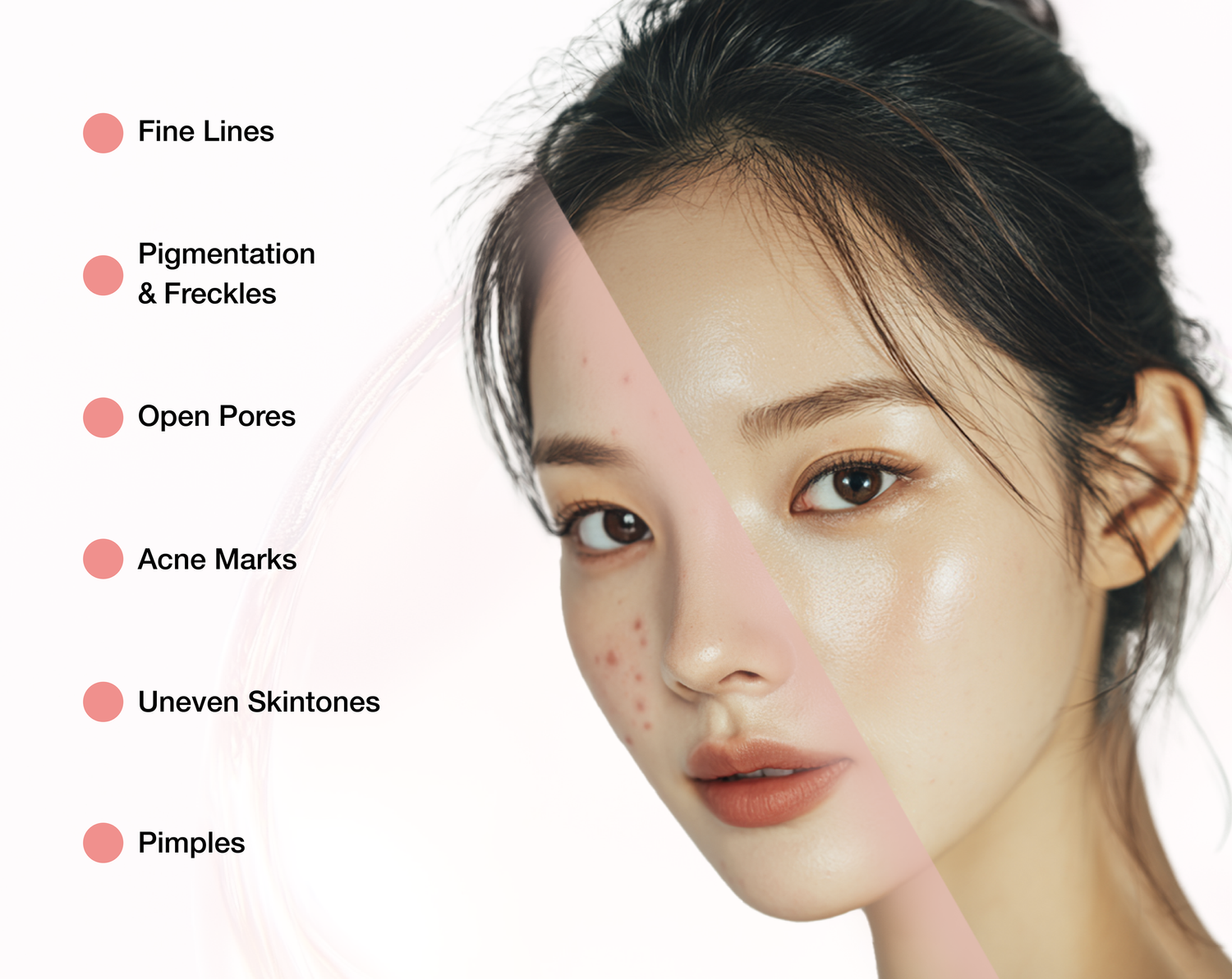 Pico Laser — Forever You Aesthetic