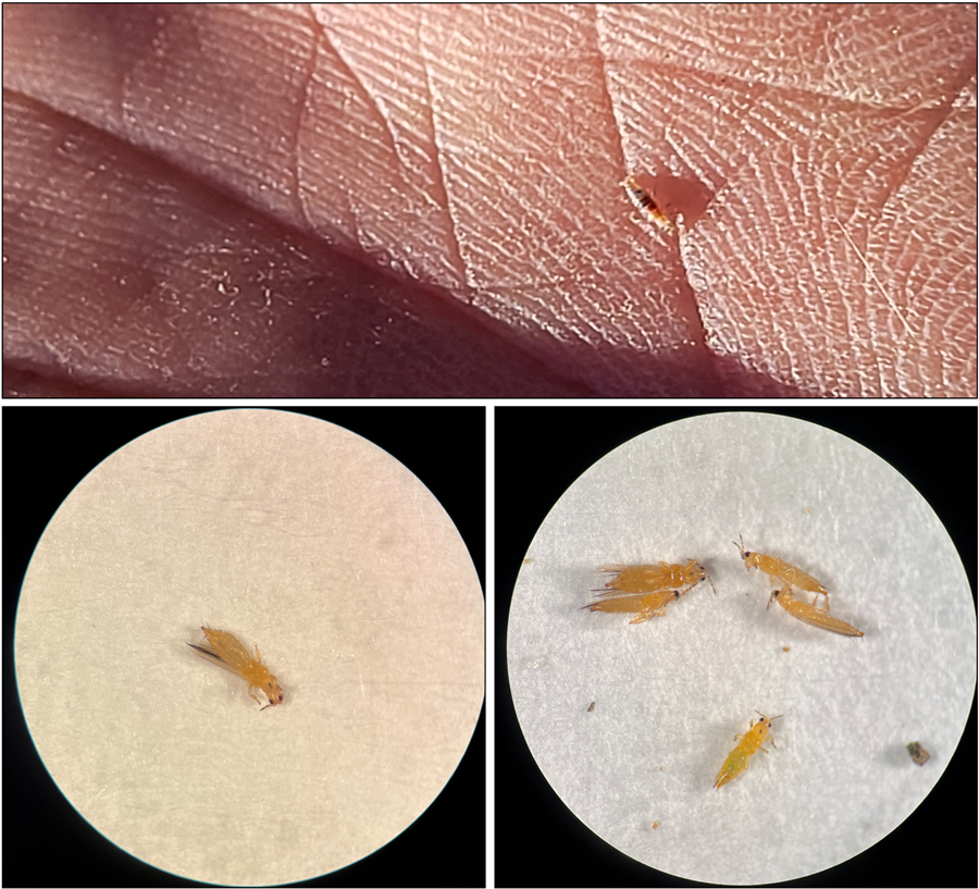 Flower Thrips and Odd Almond Foliar and Stem Growth — SJV Trees and Vines