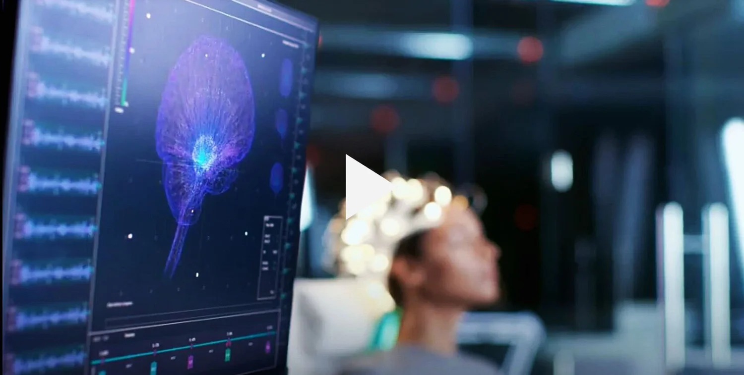 Alzheimers — BrainMind