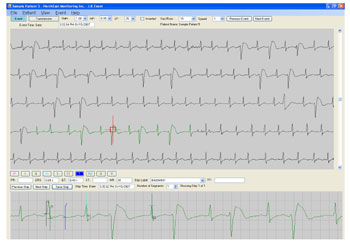 Cardiology — Image Monitoring Inc
