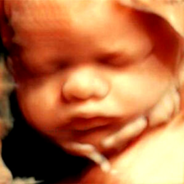 $49 - 5 Stars - Ultrasound 3D 4D 5D 8K - in Kissimmee Florida near ...