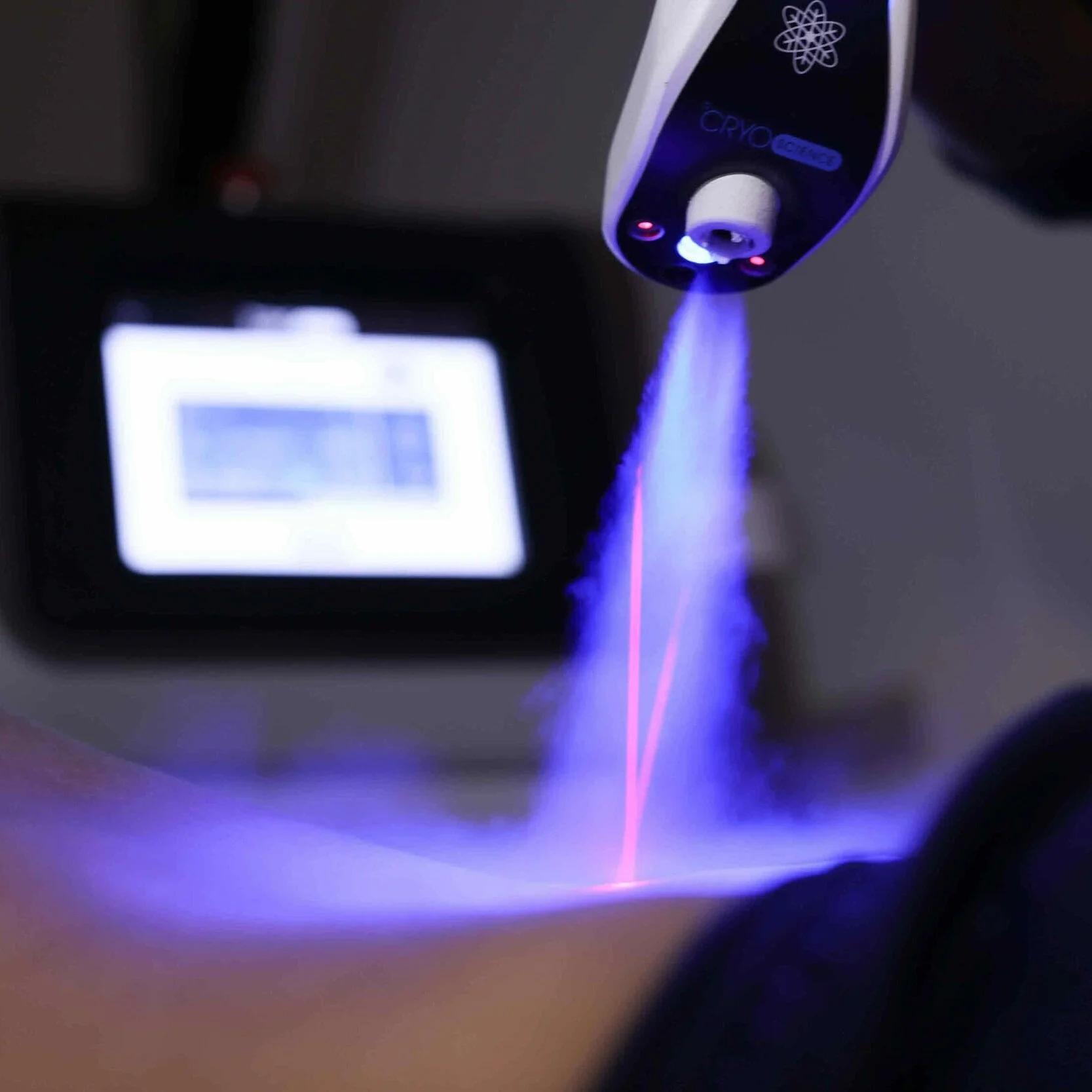 Cryotherapy North East