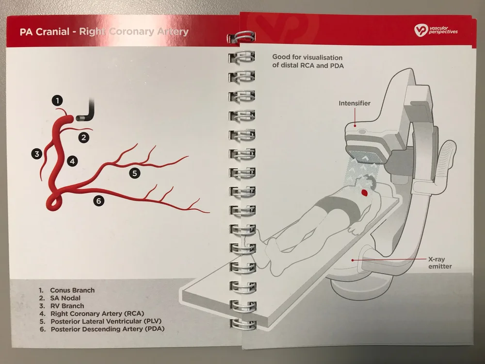 Coronary Angiogram — Golden Shutter Films
