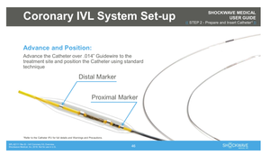SHOCKWAVE IVL (IntraVascular Lithotripsy) — Golden Shutter Films