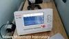 Common Watch QC Problems To Look Out For | Consider These Before Buying ...