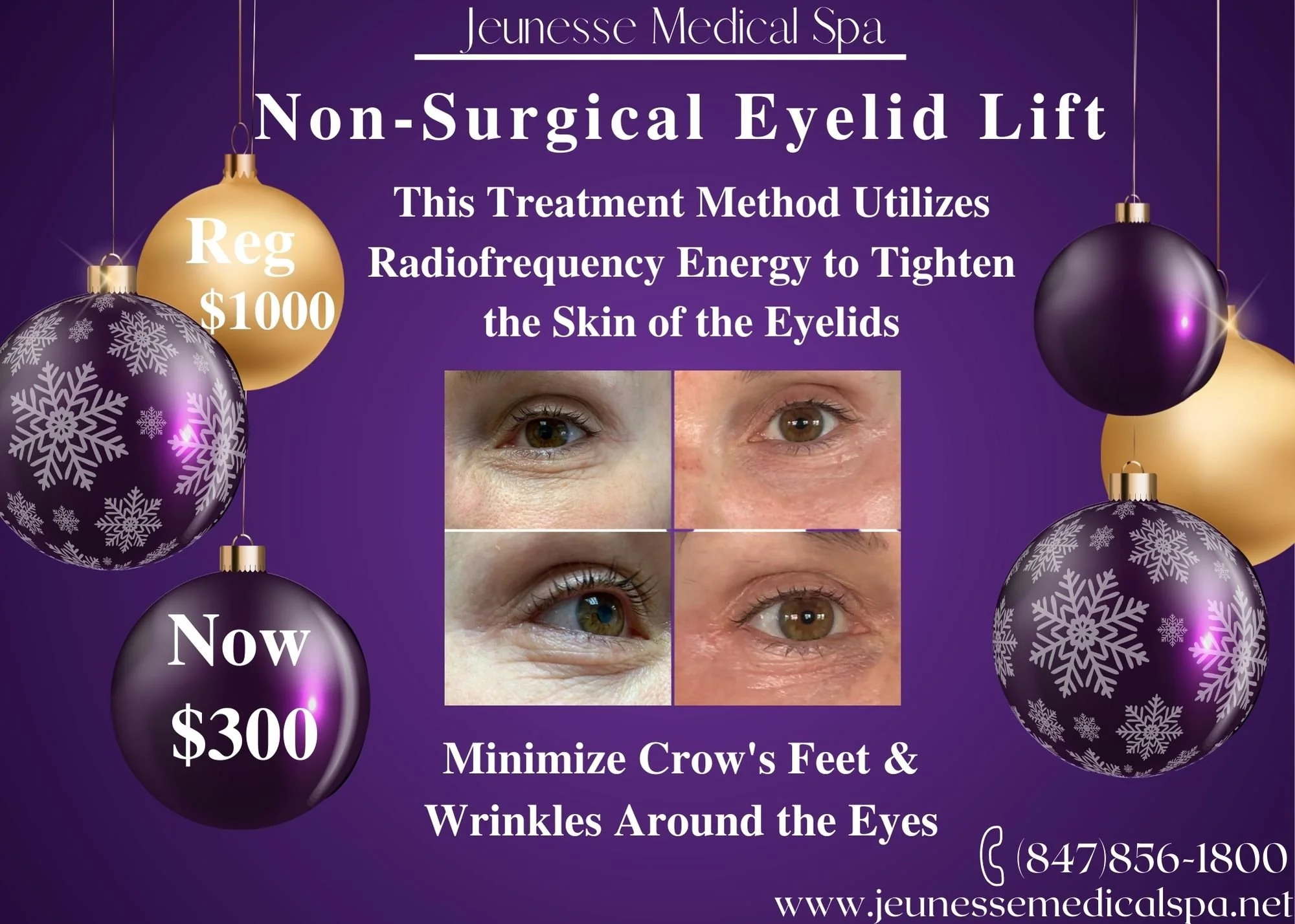 NON-SURGICAL EYELID LIFT — Jeunesse Medical Spa