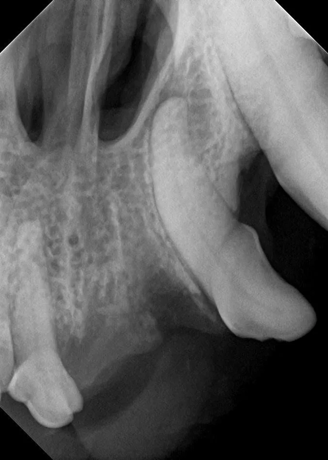 Nick's Day at the Dentist - Divine Dentistry