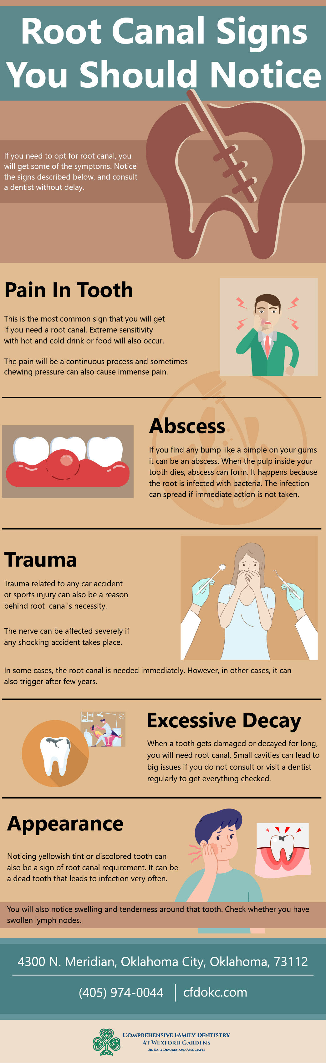 Root Canal Signs You Should Notice