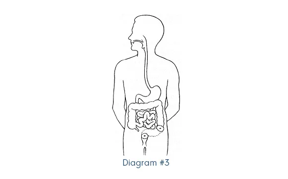 About Ostomies — Ostomy Halifax