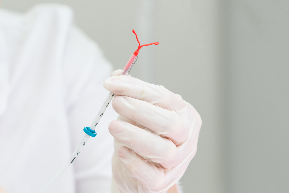 What a Painless IUD Removal Specialist in Columbia, Maryland Wants You ...