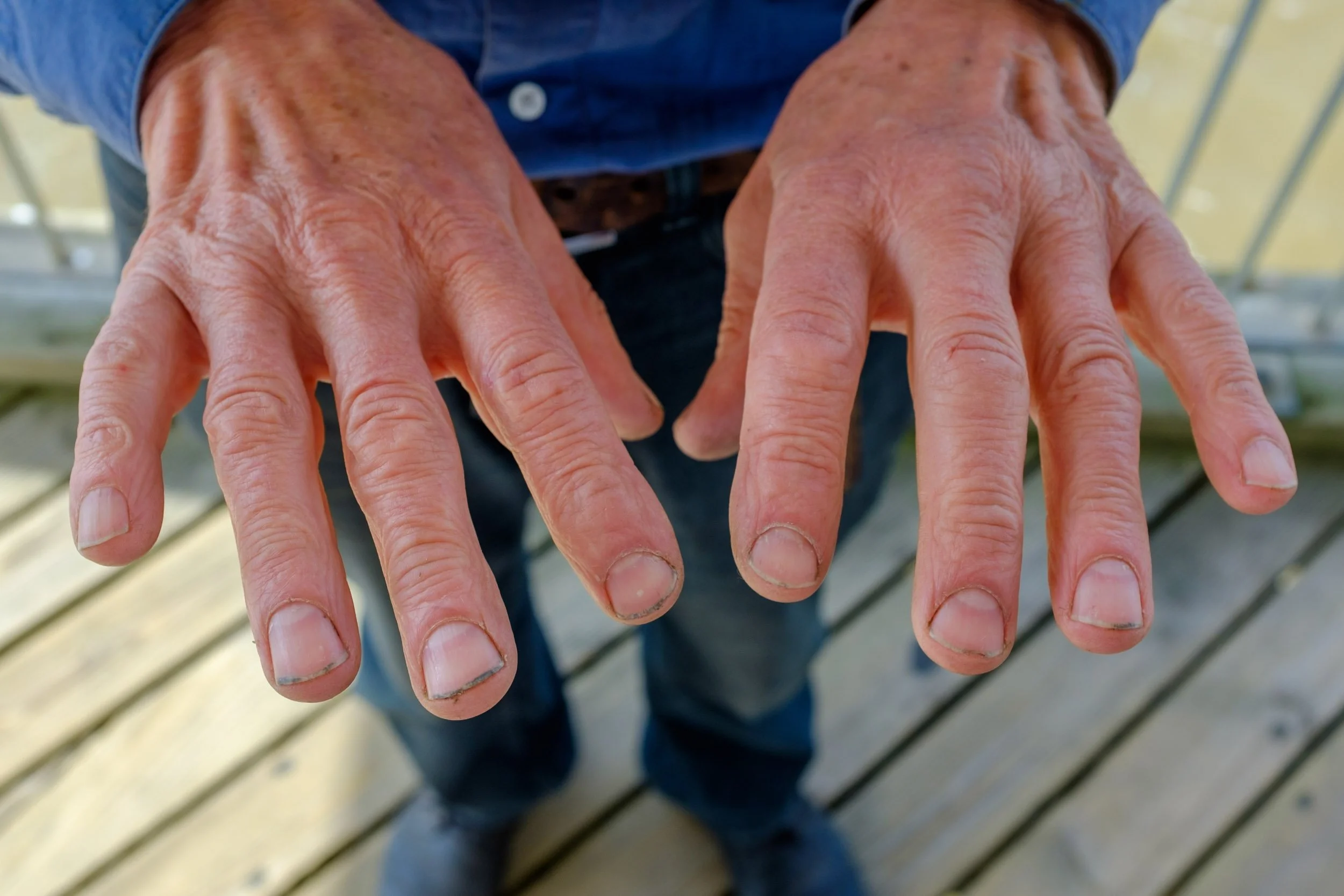 Hands Down — Michael Goldrei Photography