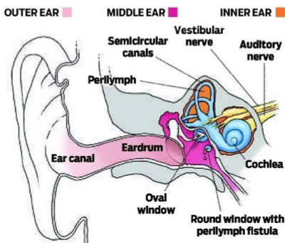 Endolymphatic Hydrops In Adults