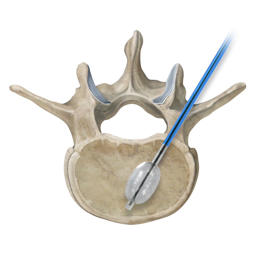 Osteo site IZI Medical osteo-site-izi-medical