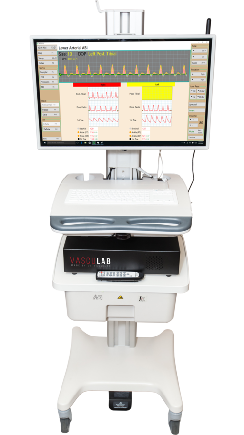VascuLab GSX • Vascular Ultrasound Device • VascuLab