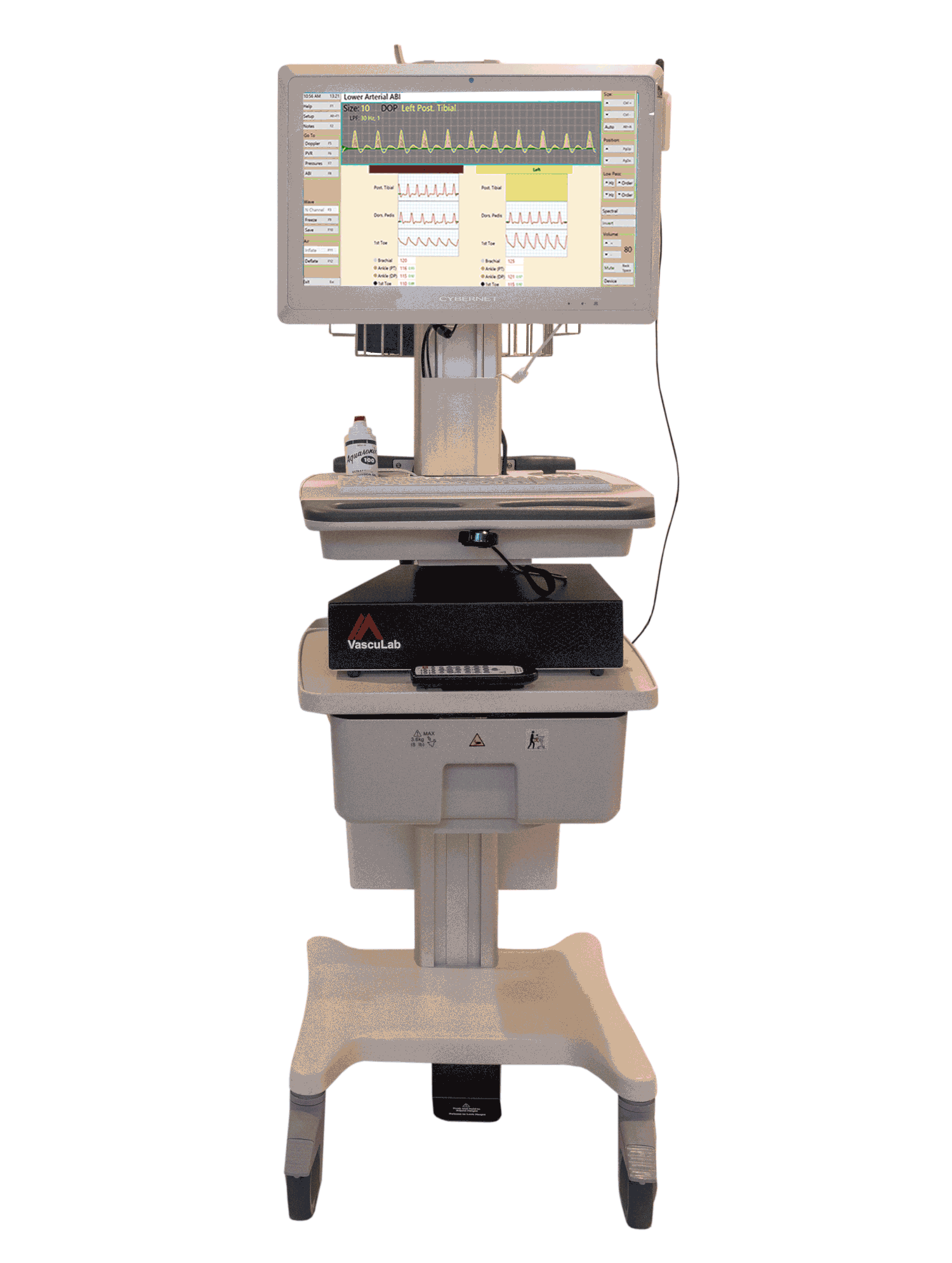 VascuLab GSX • Vascular Ultrasound Device • VascuLab