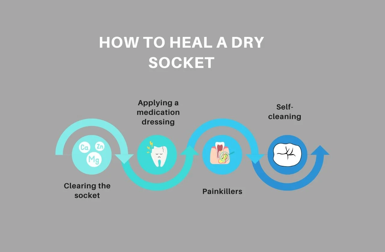 9 Effective Solutions: Dry Socket Treatment at Home — KWC Dental