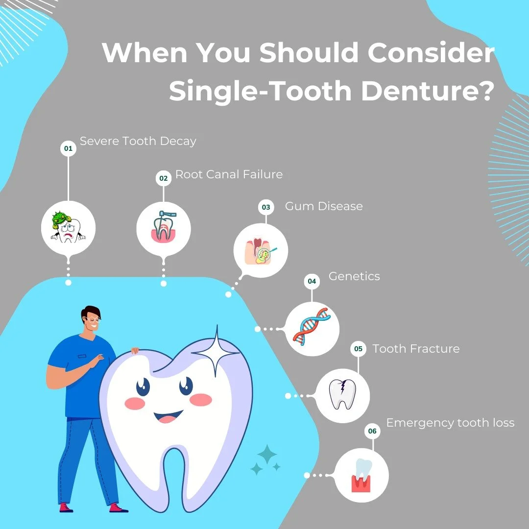 Single-Tooth Denture: Is It the Right Solution for You? — KWC Dental