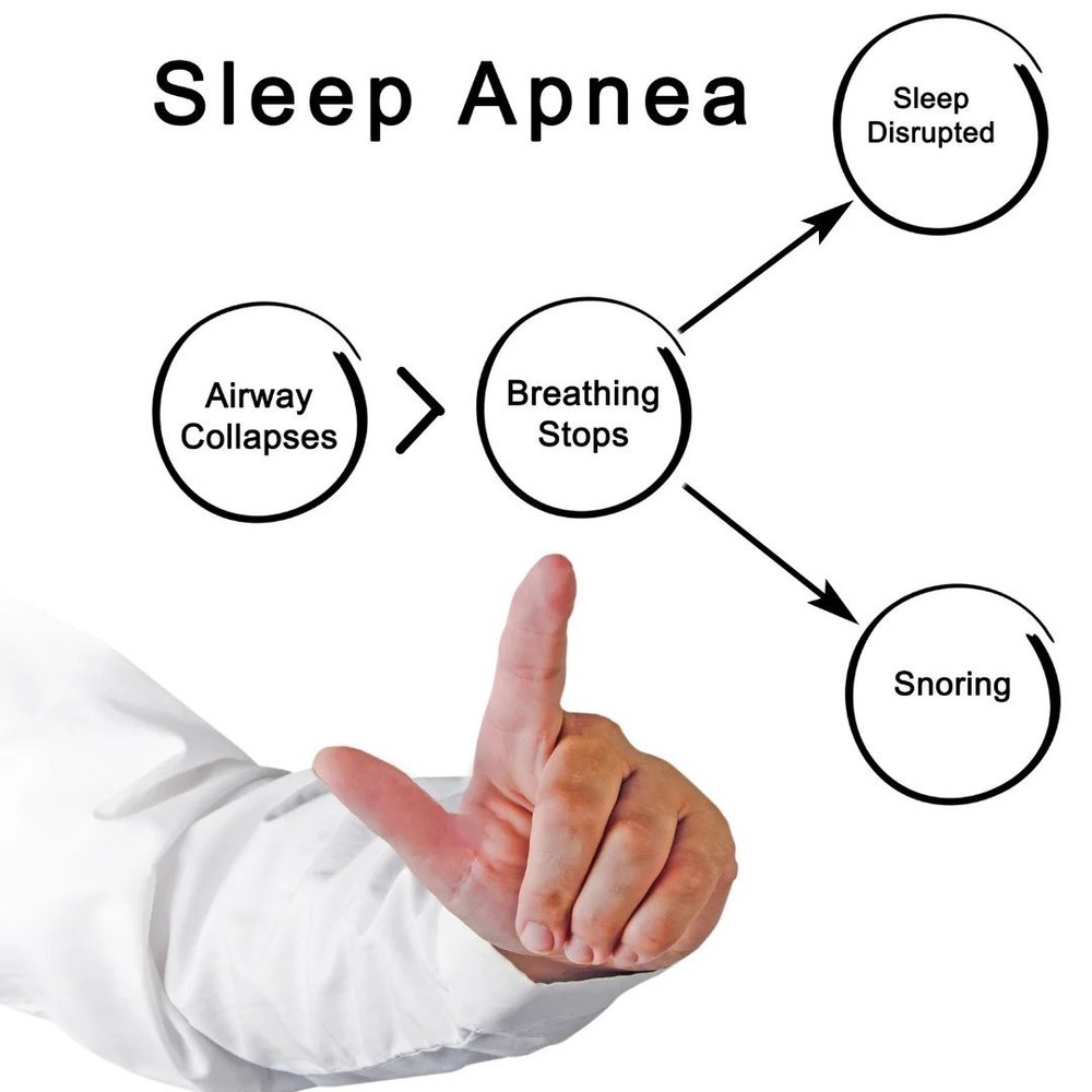 A Complete Guide to Sleep Apnea Mouth Guards — KWC Dental