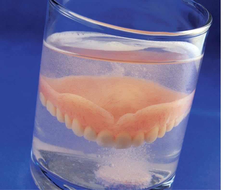 Denture Cleaning Tablets: 5 Best Ones in 2023 - KWC Dental