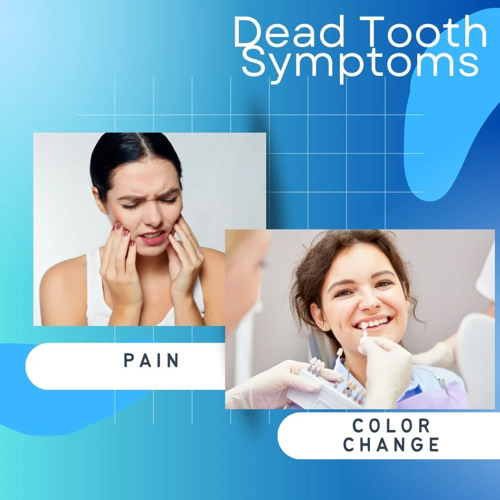 Dead Tooth: Symptoms, Risks & Immediate Steps to Take — KWC Dental