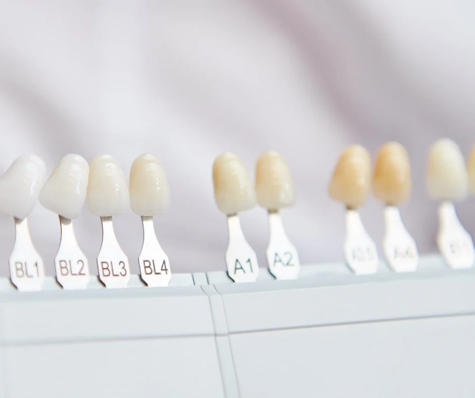 Different Types of Tooth Discoloration & Their Causes — KWC Dental