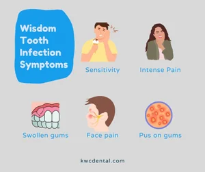 Top 10 Wisdom Tooth Infection Symptoms | KWC Dental — KWC Dental