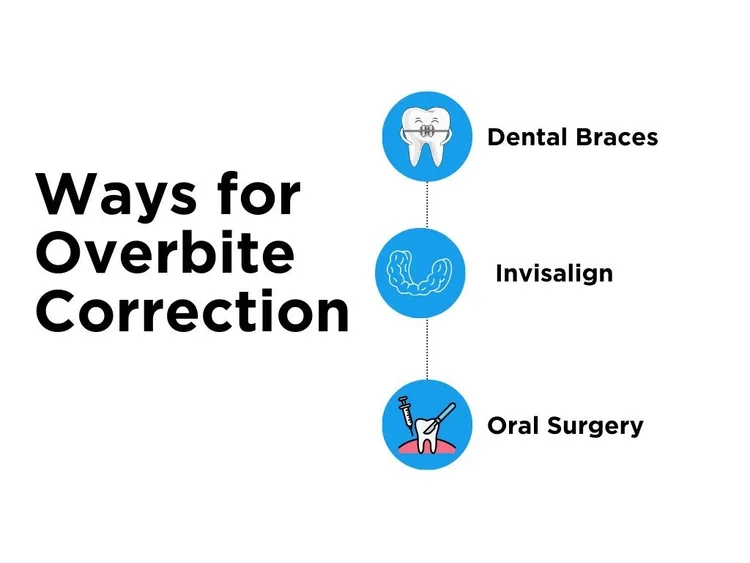 3 Overbite Correction Treatments For the Happiest Smile — KWC Dental