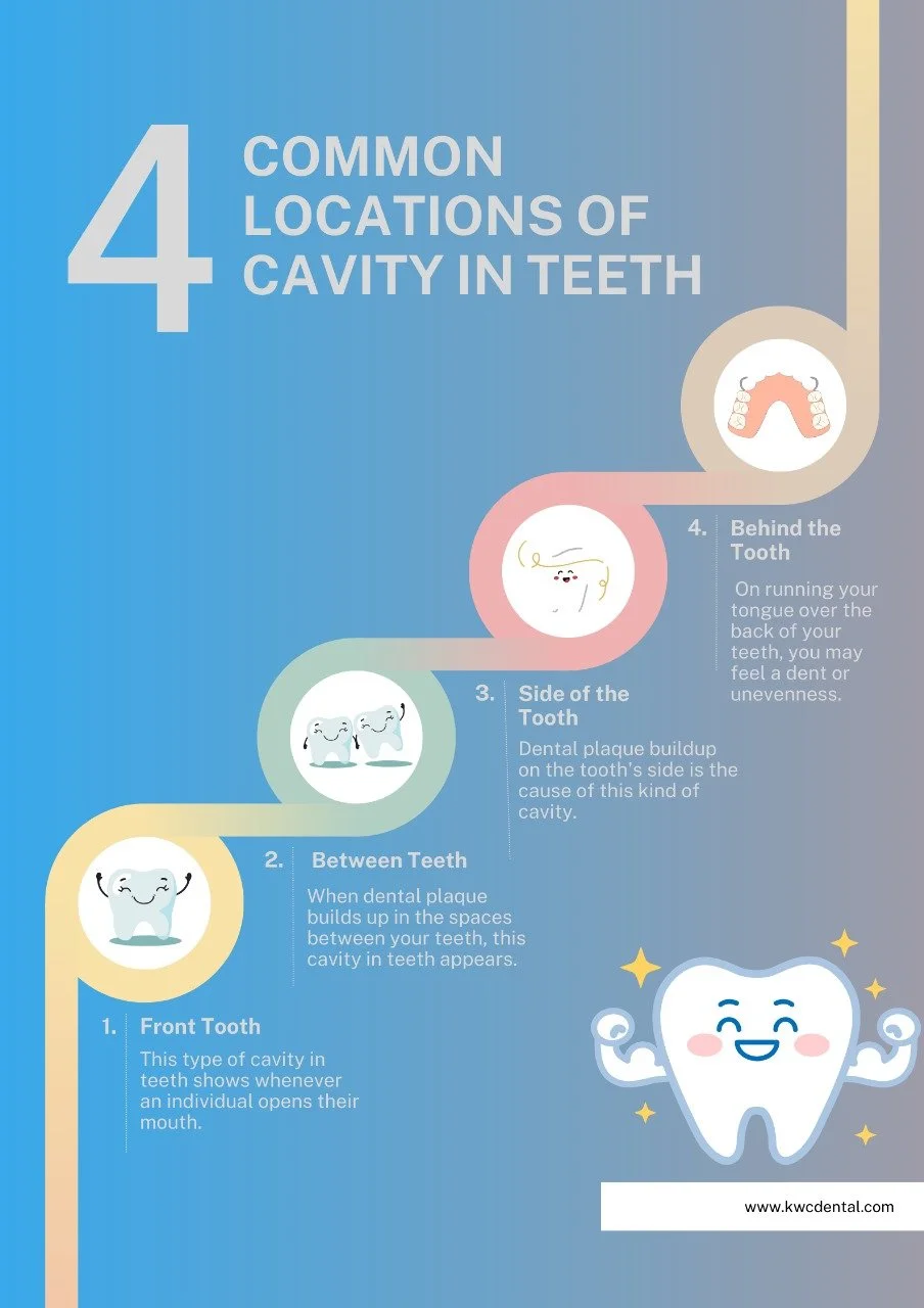 Cavity in Teeth: Early Signs, Treatments & Prevention — KWC Dental