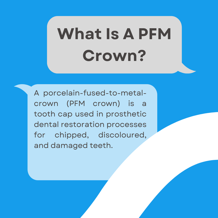The Beginner’s Guide To A PFM Crown — KWC Dental