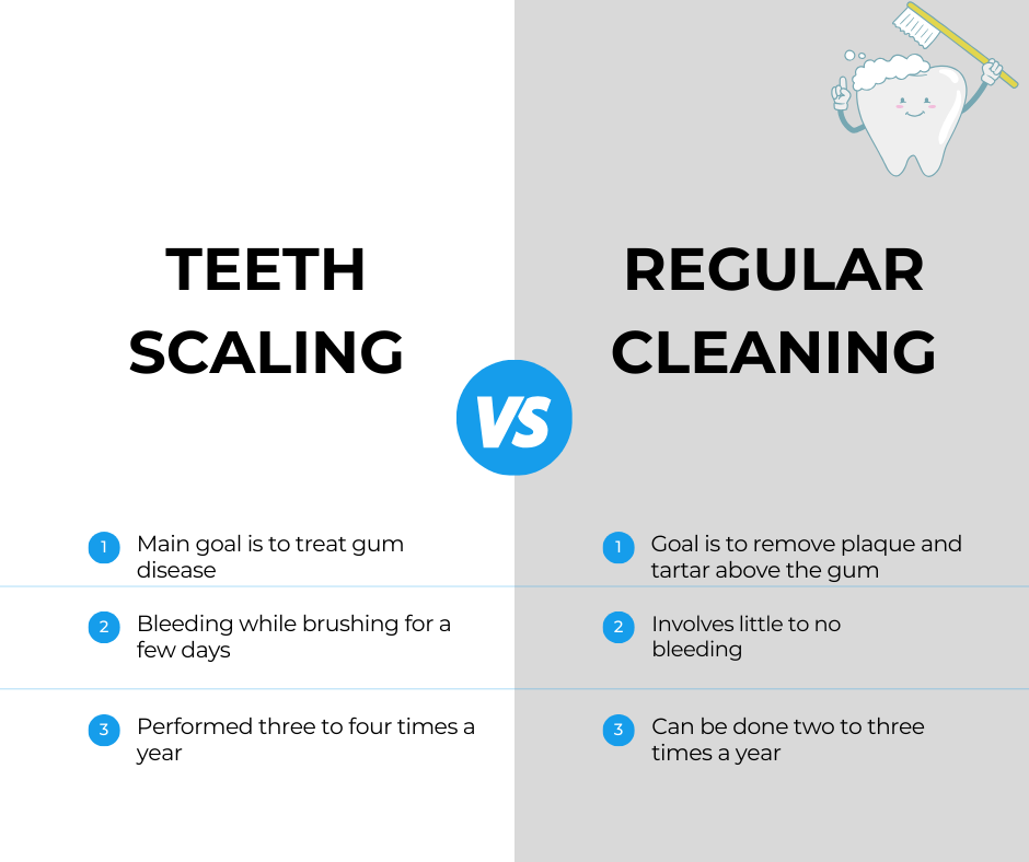 Teeth Scaling: Key to Preventing Periodontal Disease — KWC Dental