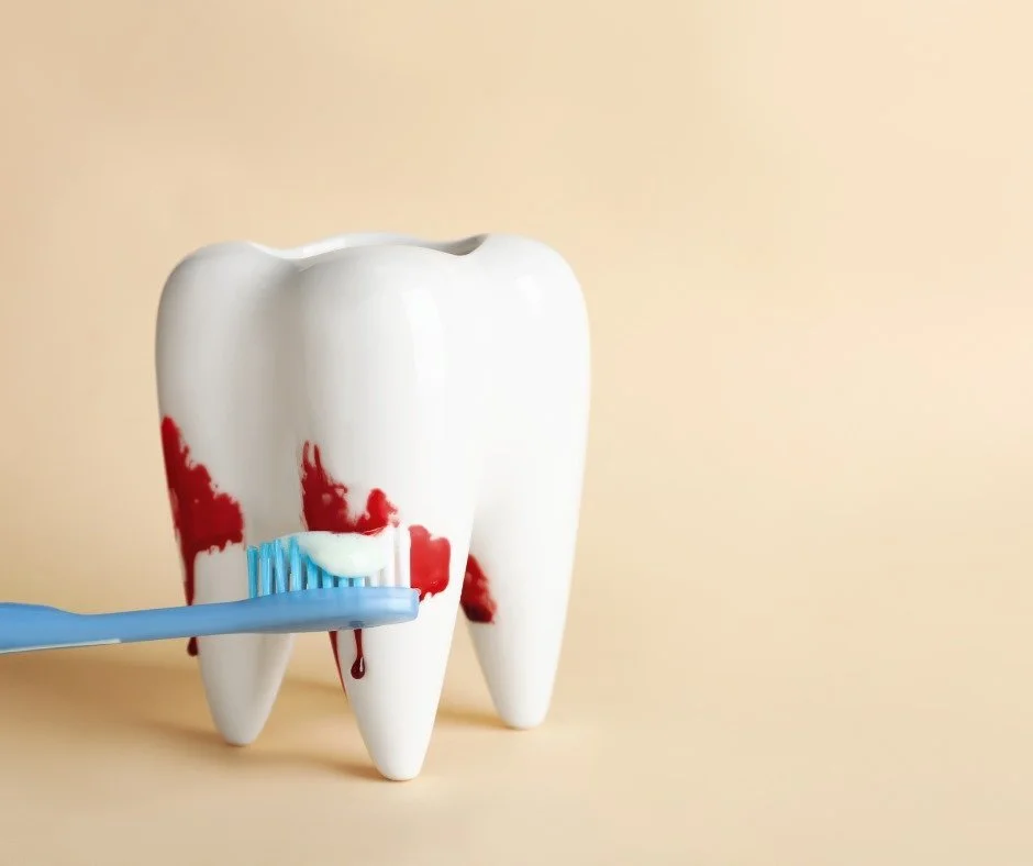 11 Best Ways to Stop Gum Bleeding Quickly at Home — KWC Dental