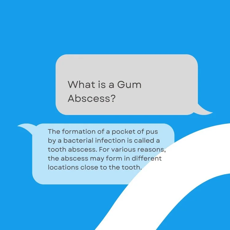 Gum Abscess Treatment: 9 Effective Methods To Try At Home — KWC Dental