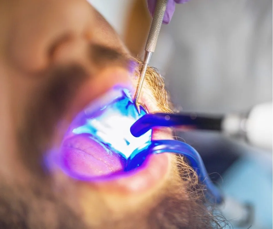 Signs of Dental Decay for Better Teeth Care — KWC Dental